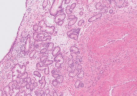 Canine and Feline Blind Bronchoalveolar Lavage (BAL) – Axiom Veterinary ...